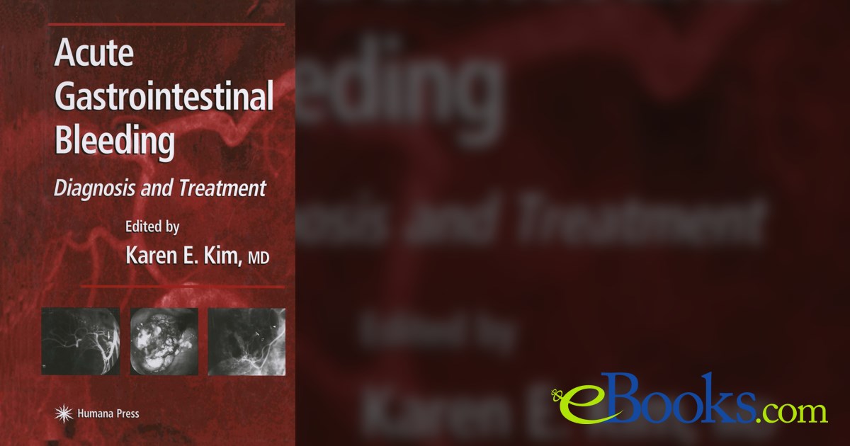 Acute Gastrointestinal Bleeding by Karen E. Kim (ebook)