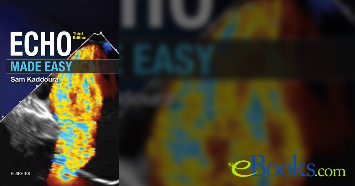 Echo Made Easy E-Book (3rd ed.)