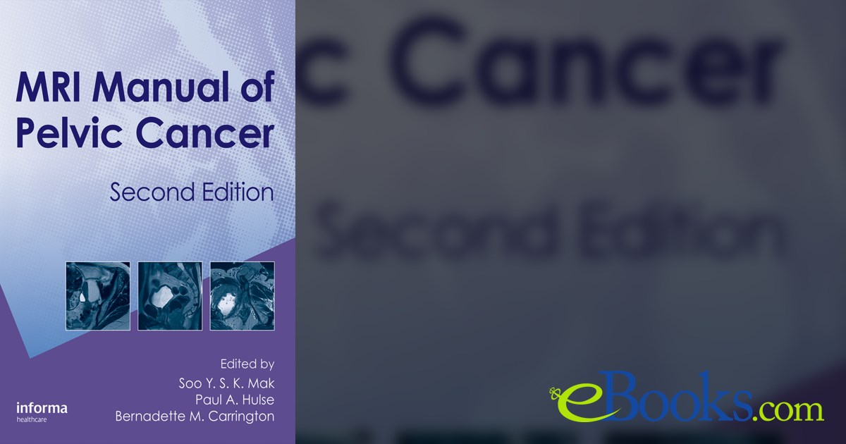 MRI Manual of Pelvic Cancer,Second Edition (2nd ed.)