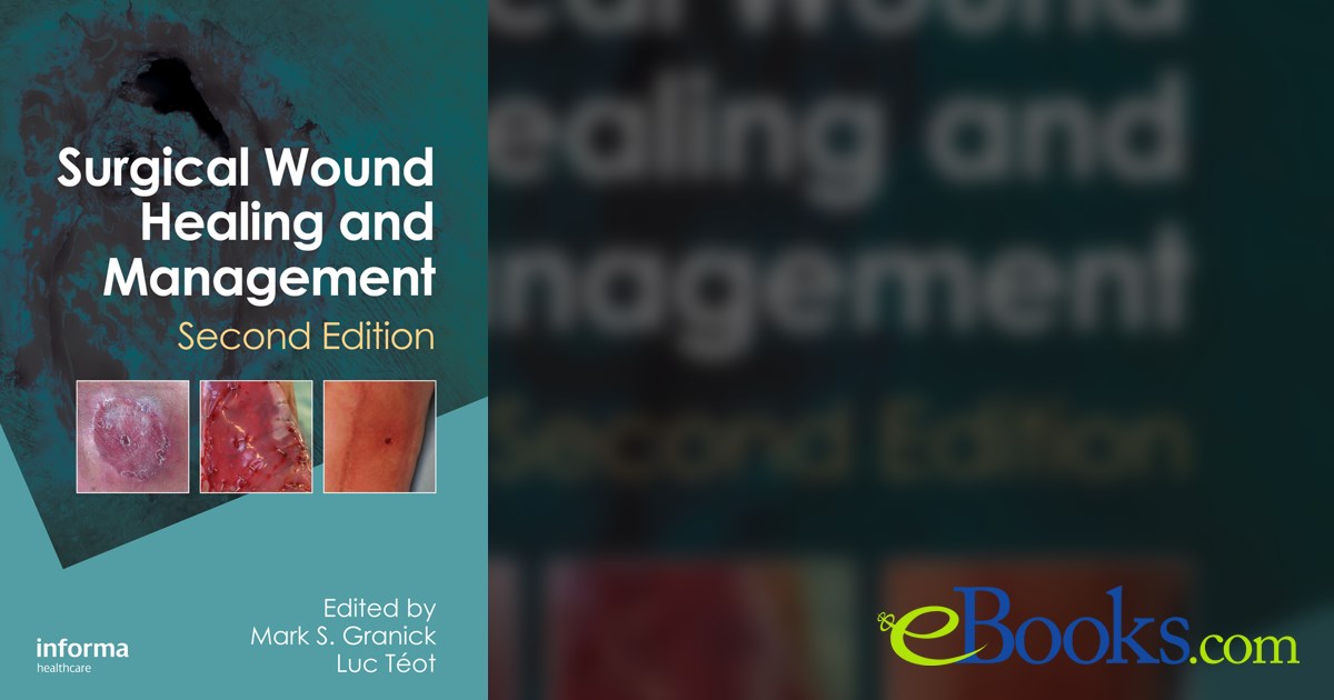 Surgical Wound Healing and Management (2nd ed.)