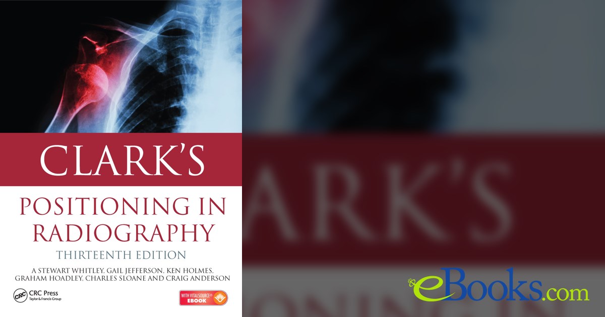 Clark's Positioning in Radiography 13E (13th ed.)