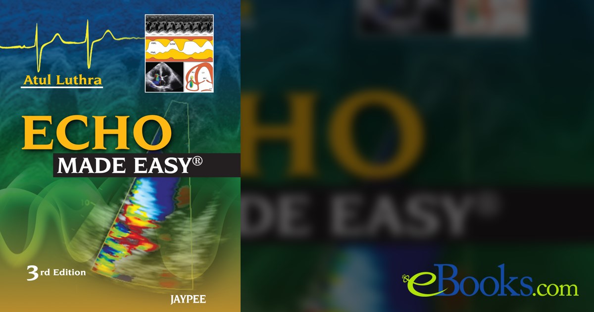 Echo Made Easy® (3rd ed.) by Luthra Atul (ebook)