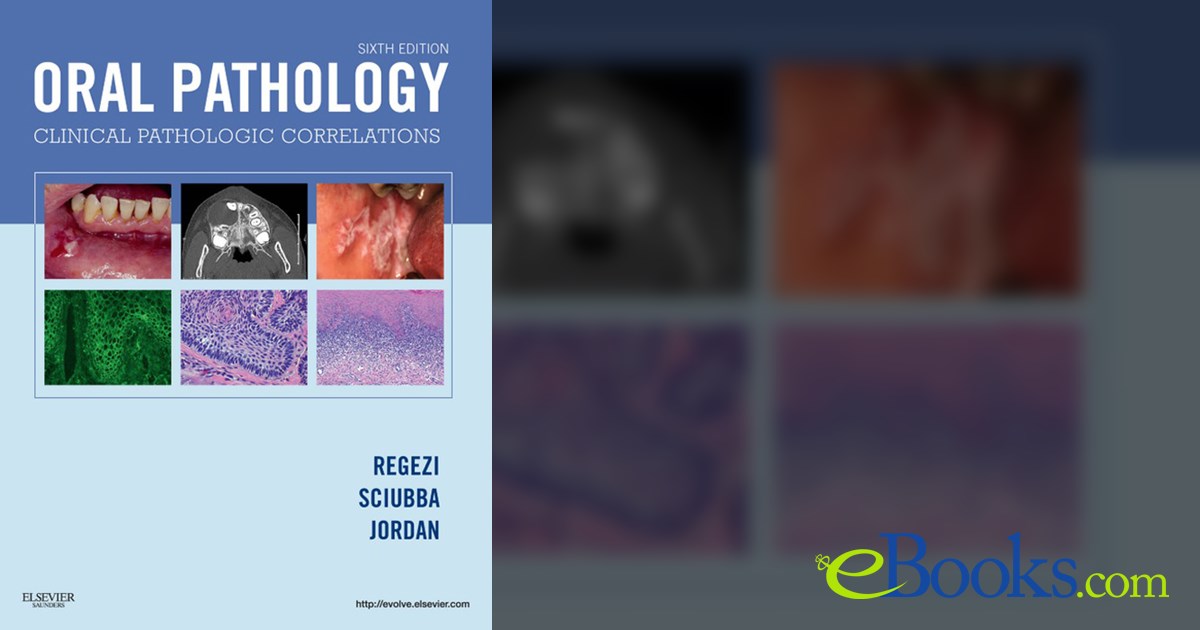 Oral Pathology - E-Book (6th ed.)