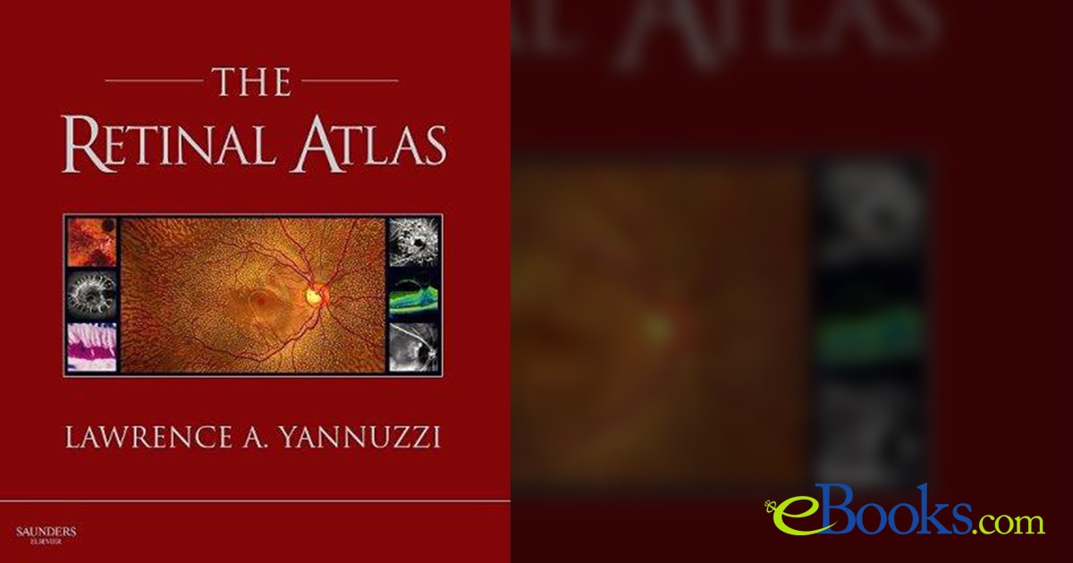 The Retinal Atlas E-Book by Lawrence A. Yannuzzi (ebook)