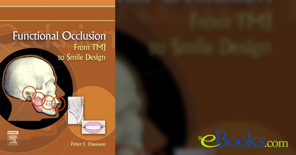 Functional Occlusion by Peter E. Dawson DDS (ebook)