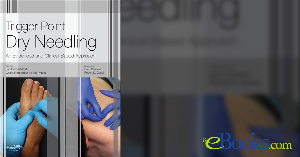 Trigger Point Dry Needling E-Book