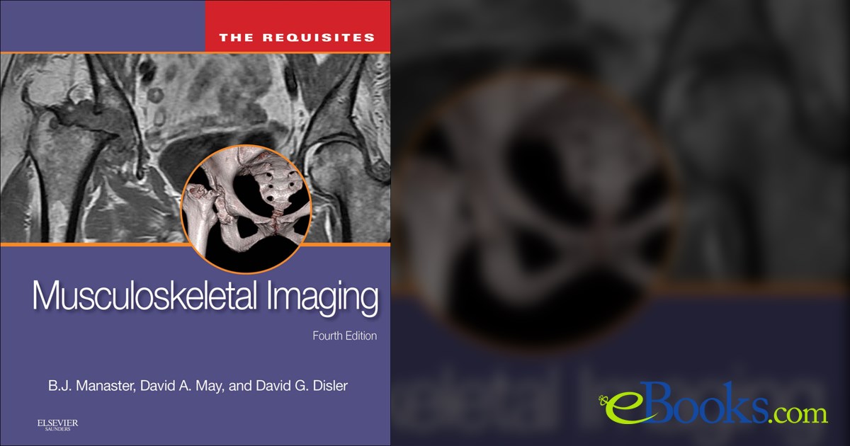 Musculoskeletal Imaging: The Requisites E-Book (4th ed.)