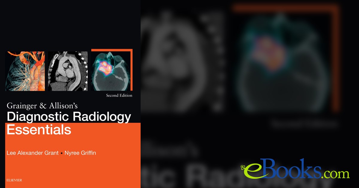Grainger & Allison's Diagnostic Radiology Essentials E-Book