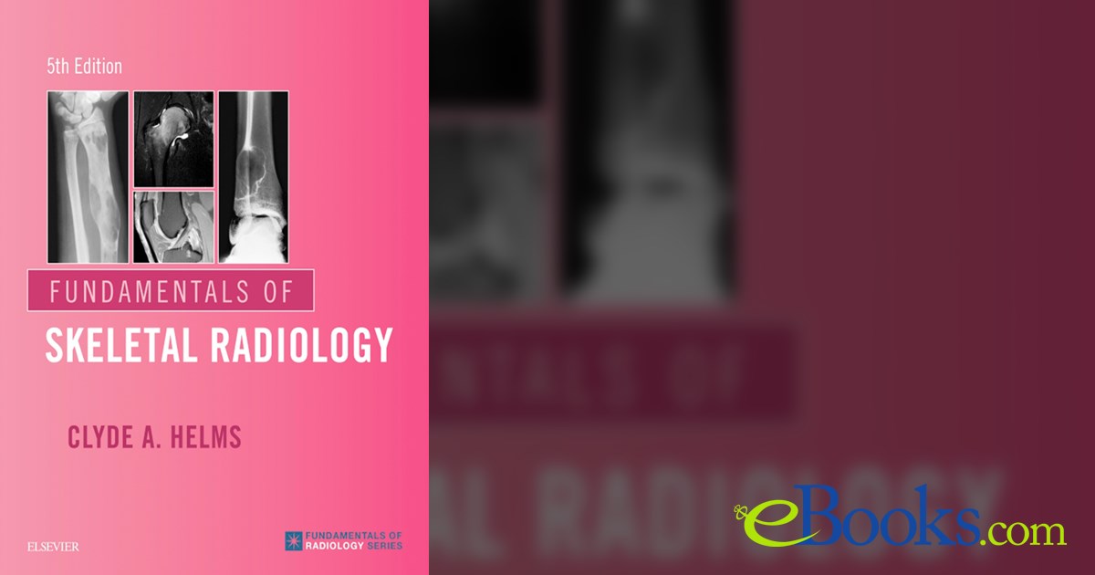 Fundamentals of Skeletal Radiology E-Book (5th ed.)