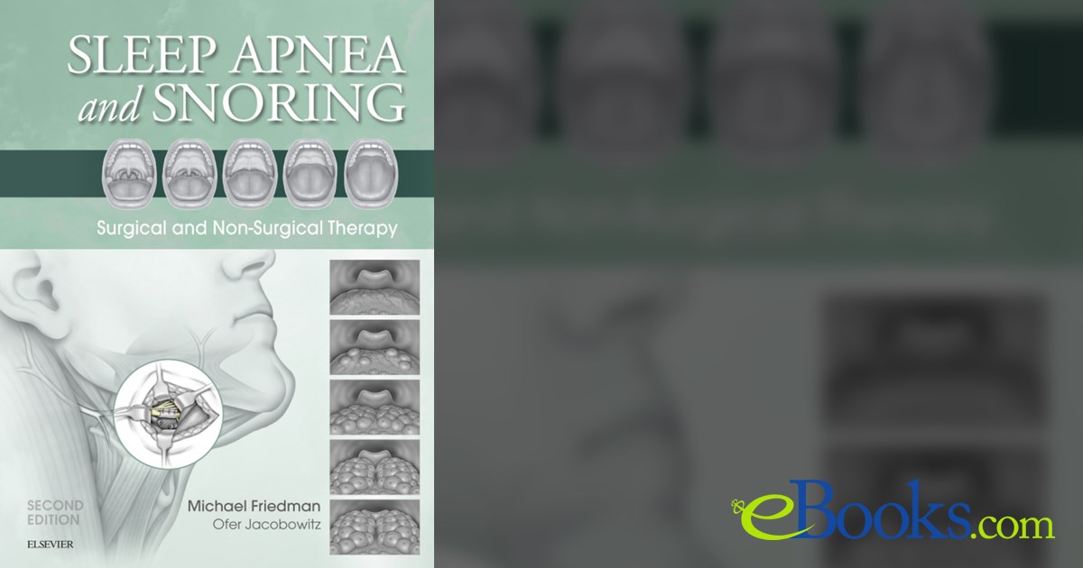 Sleep Apnea and Snoring E-Book (2nd ed.)