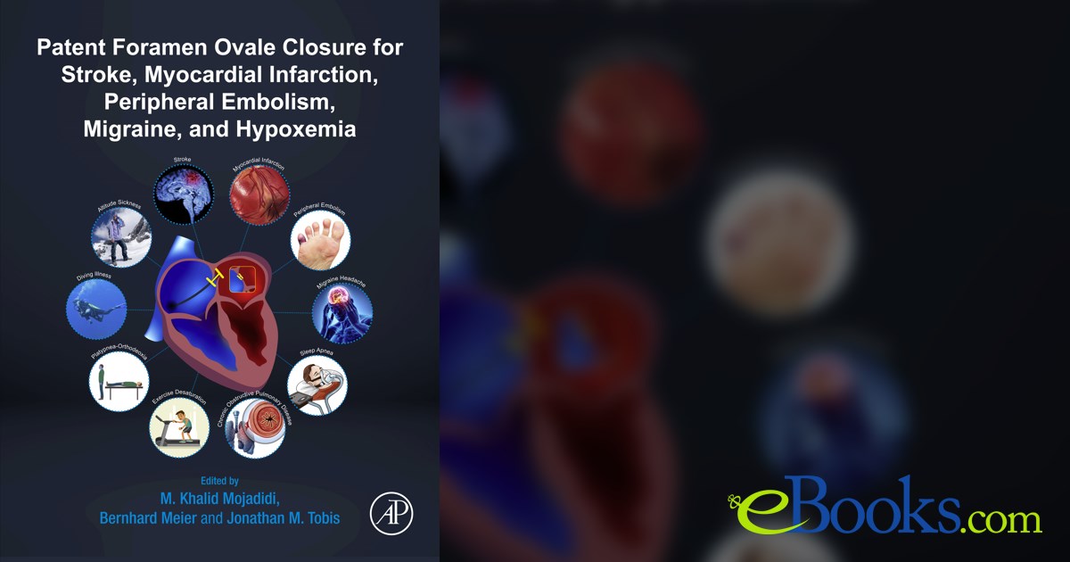 Patent Foramen Ovale Closure for Stroke, Myocardial Infarction ...