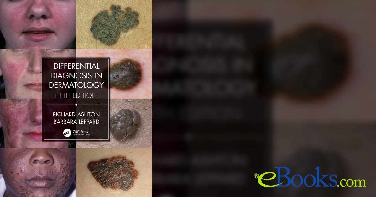 Differential Diagnosis in Dermatology (5th ed.)