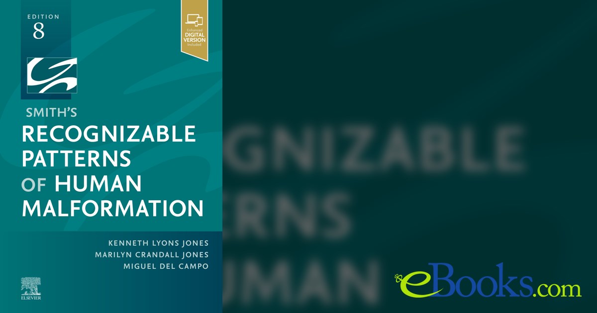 Smith's Recognizable Patterns of Human Malformation - E-Book