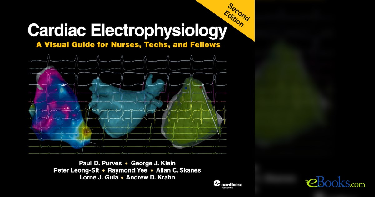 Cardiac Electrophysiology: A Visual Guide for Nurses, Techs, and ...