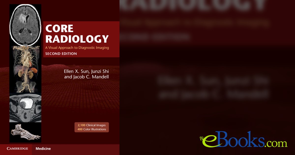 Core Radiology (2nd ed.) by Ellen X. Sun (ebook)