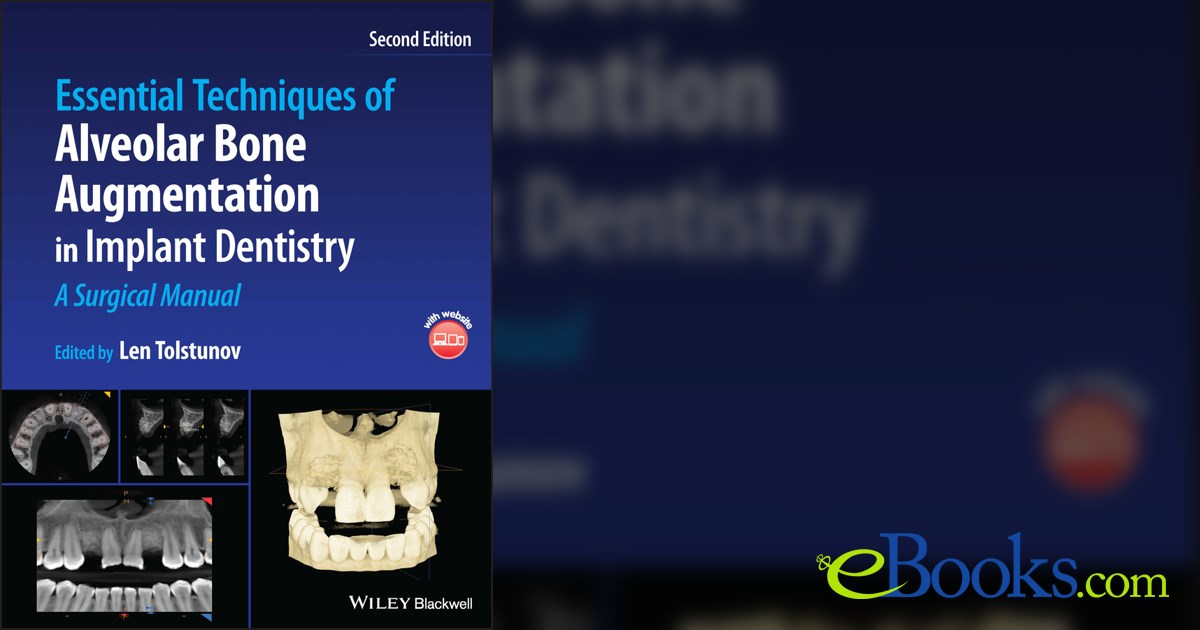 Essential Techniques of Alveolar Bone Augmentation in Implant Dentistry