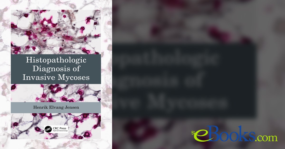 Histopathologic Diagnosis of Invasive Mycoses