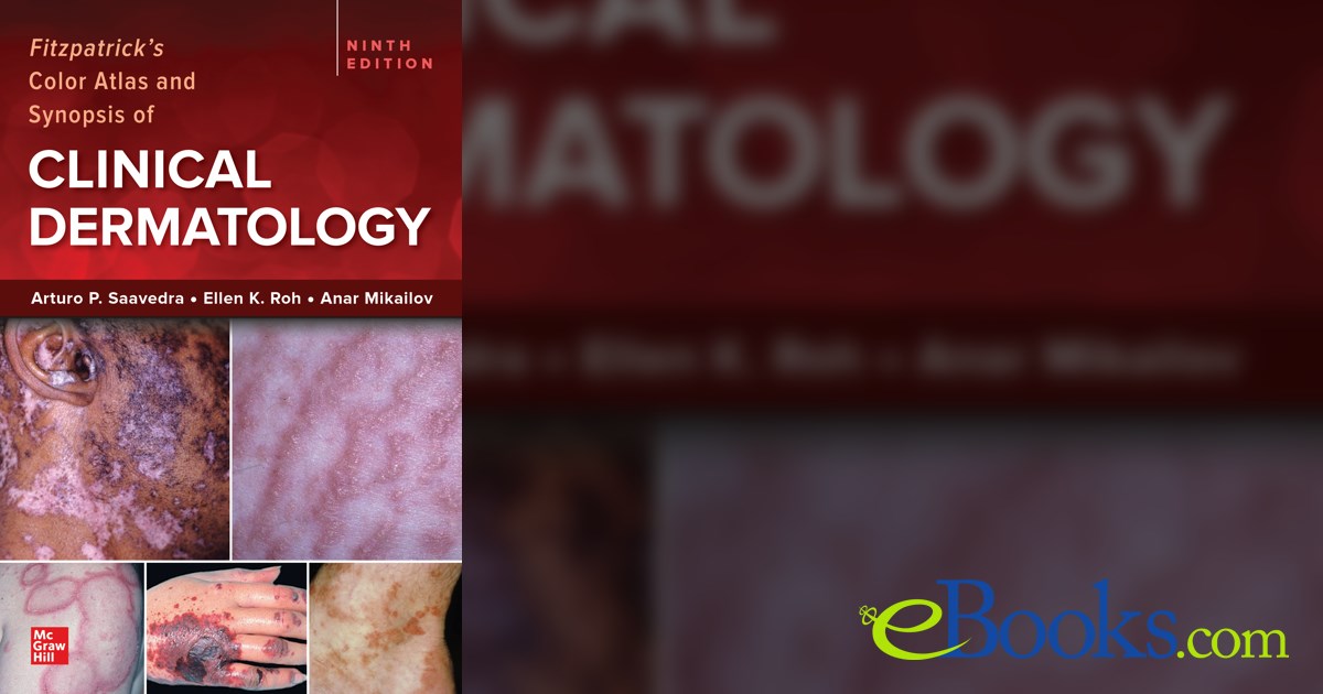 Fitzpatrick's Color Atlas and Synopsis of Clinical Dermatology, 9/e