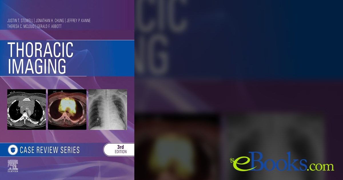 Thoracic Imaging: Case Review Series E-Book (3rd ed.)