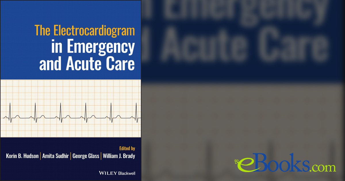 The Electrocardiogram in Emergency and Acute Care