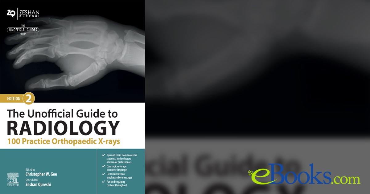 The Unofficial Guide to Radiology: 100 Practice Orthopaedic X-rays