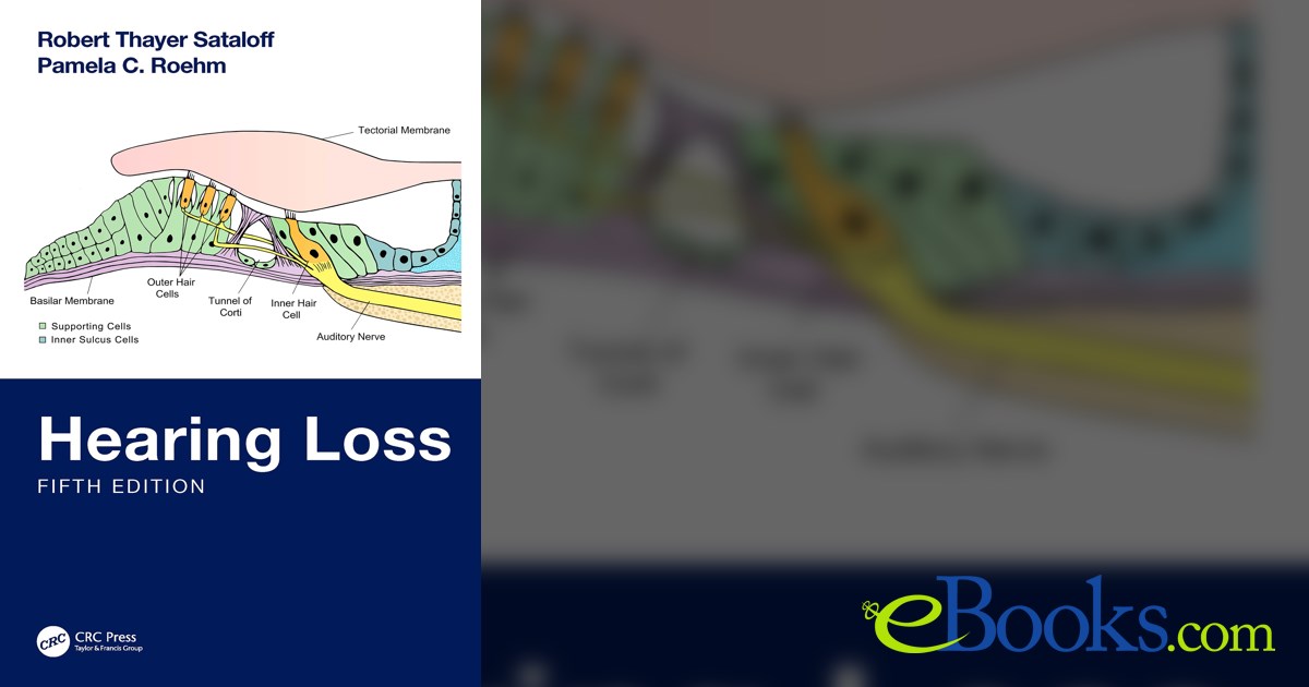 Hearing Loss (5th ed.) by Robert Thayer Sataloff (ebook)