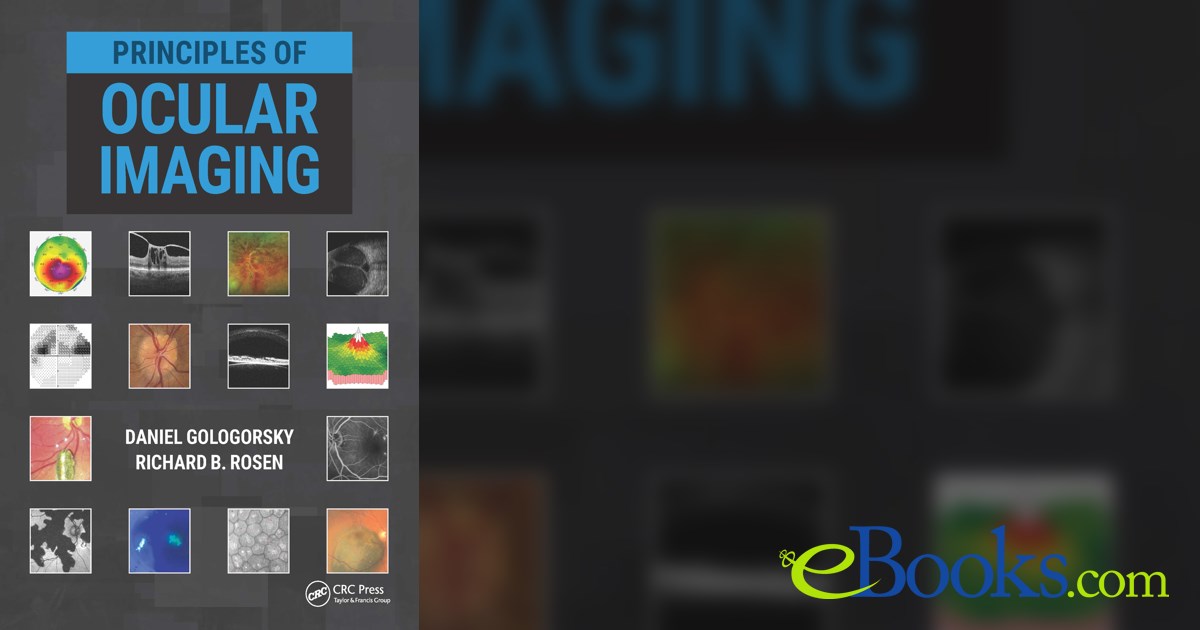 Principles of Ocular Imaging by Daniel Gologorsky (ebook)