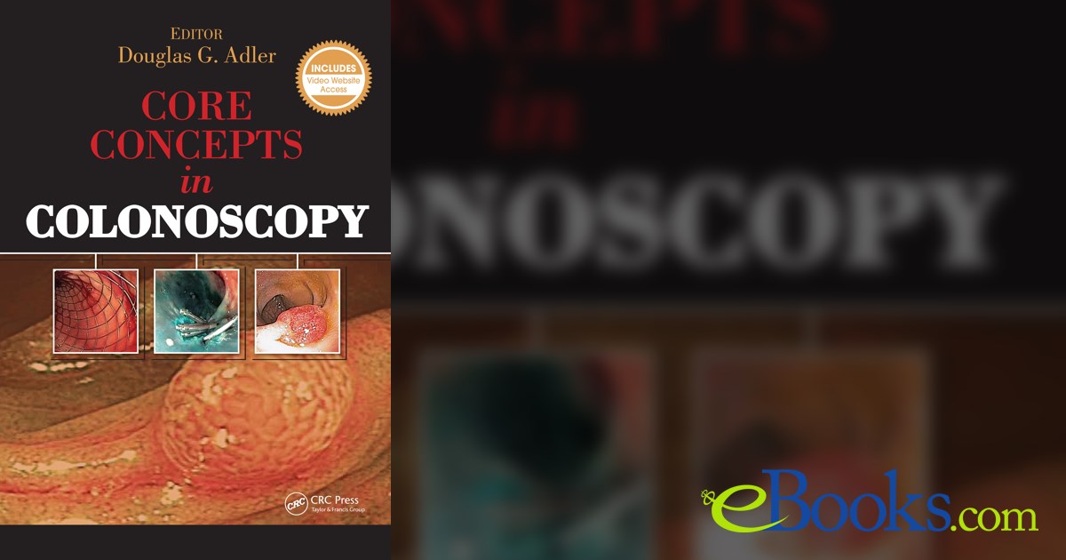 Core Concepts in Colonoscopy by Douglas Adler (ebook)
