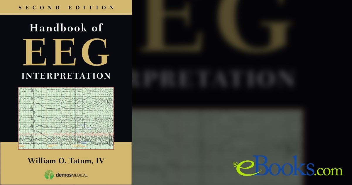 Handbook of EEG Interpretation, Second Edition (2nd ed.)