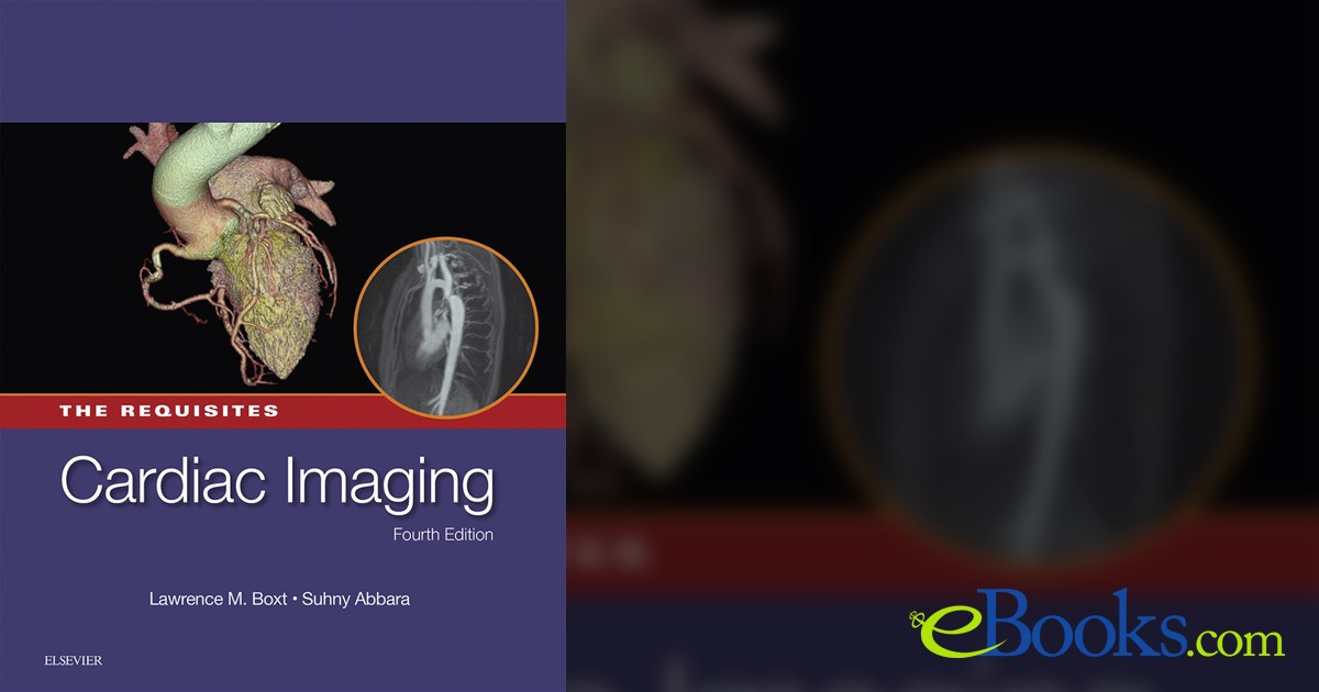 Cardiac Imaging: The Requisites E-Book (4th ed.)