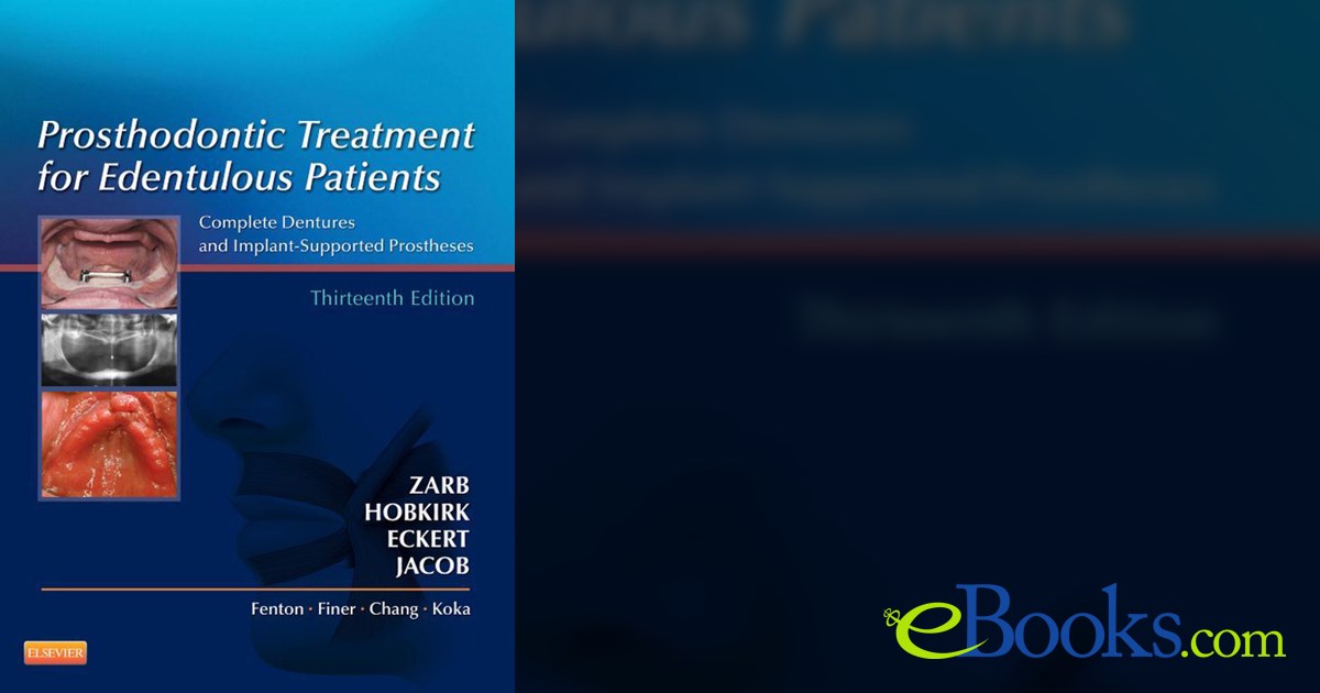 Prosthodontic Treatment for Edentulous Patients (13th ed.)