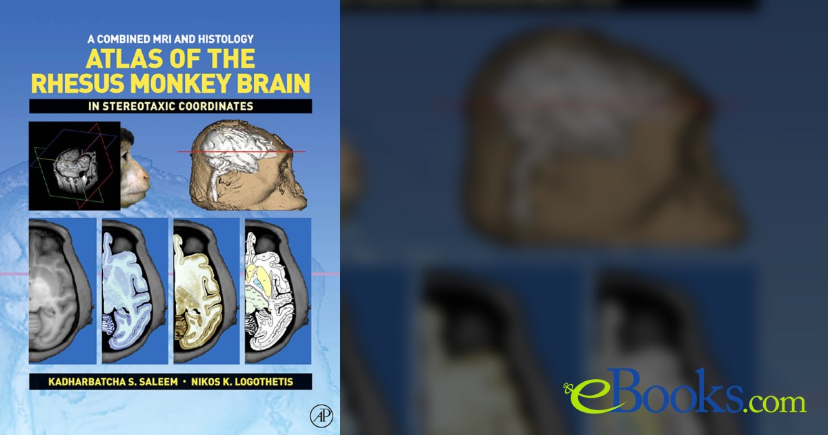 A Combined MRI and Histology Atlas of the Rhesus Monkey Brain in ...