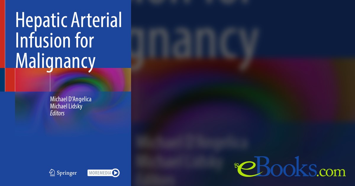 Hepatic Arterial Infusion for Malignancy
