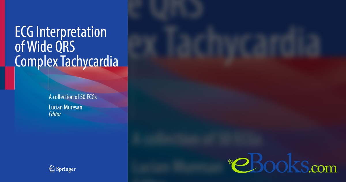 ECG Interpretation of Wide QRS Complex TachycardiaÂ