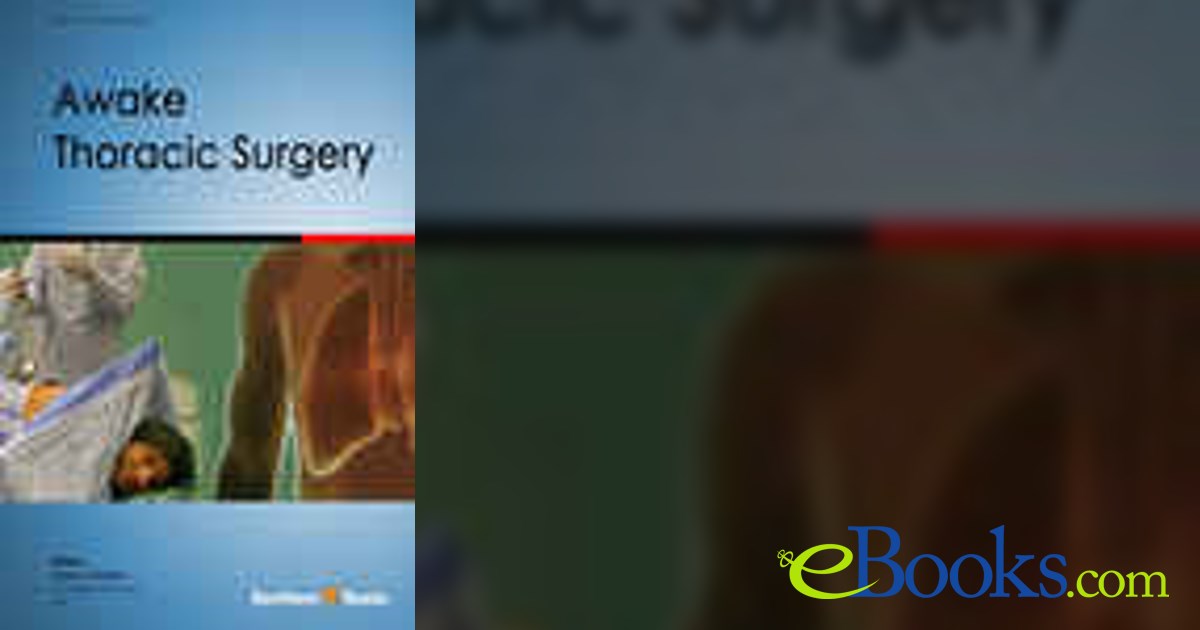 Awake Thoracic Surgery by Eugenio Pompeo (ebook)