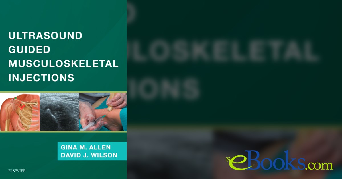 Ultrasound Guided Musculoskeletal Injections E-Book