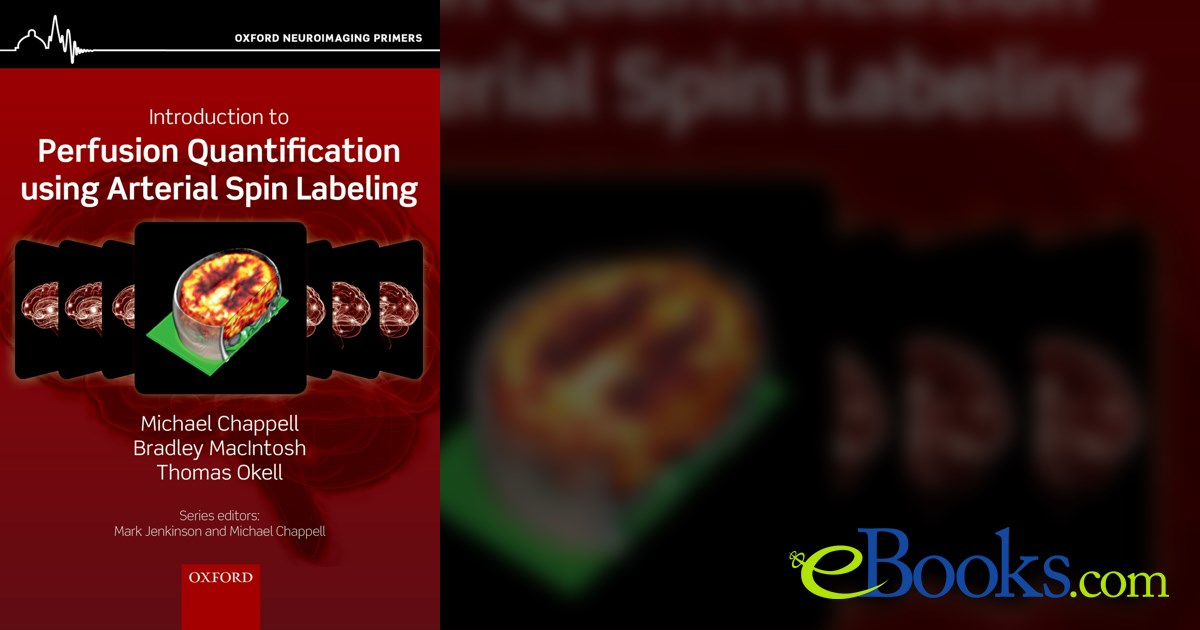 Introduction to Perfusion Quantification using Arterial Spin Labelling