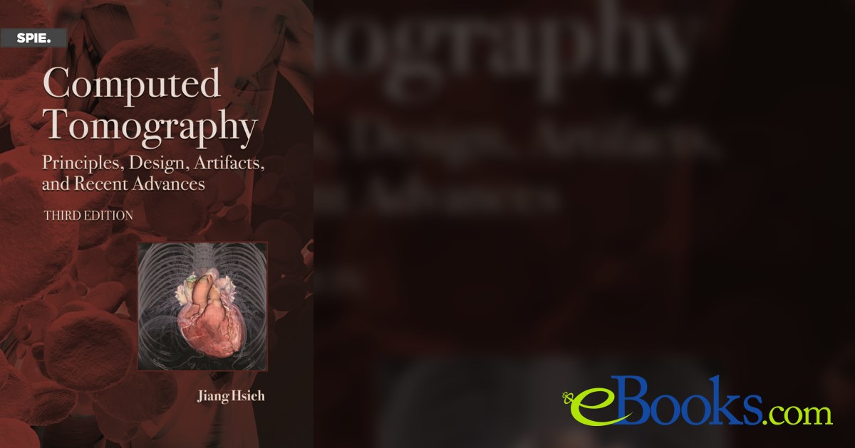 Computed Tomography: Principles, Design, Artifacts, and Recent Advances ...