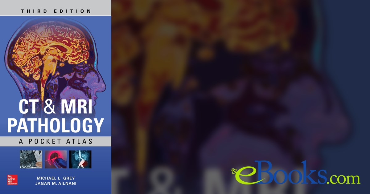 CT & MRI Pathology: A Pocket Atlas, Third Edition (3rd ed.)