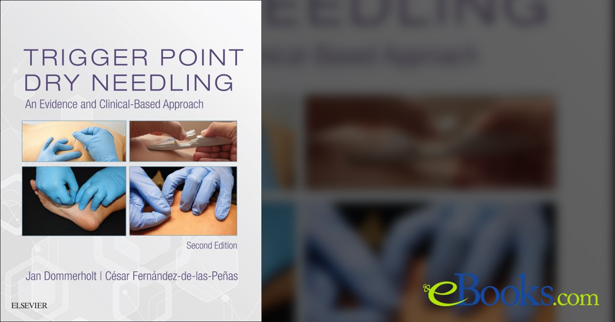 Trigger Point Dry Needling E-Book (2nd ed.)