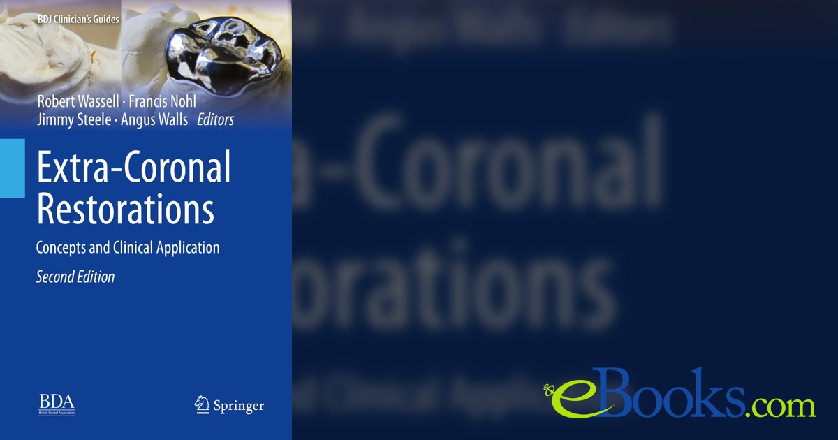 Extra-Coronal Restorations (2nd ed.) by Robert Wassell (ebook)