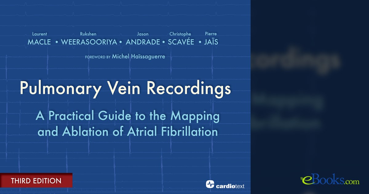 Pulmonary Vein Recordings : A Practical Guide to the Mapping and ...