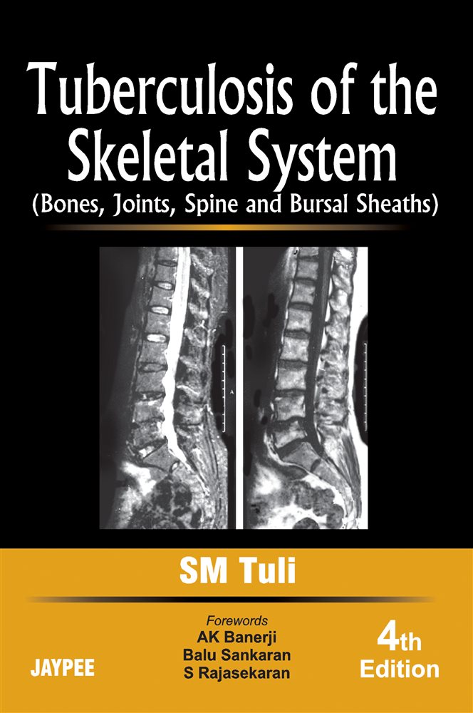 Tuberculosis of The Skeletal System (4th ed.) by S. M. Tuli (ebook)