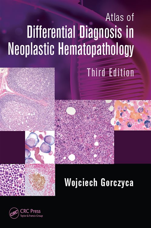 Atlas of Differential Diagnosis in Neoplastic Hematopathology