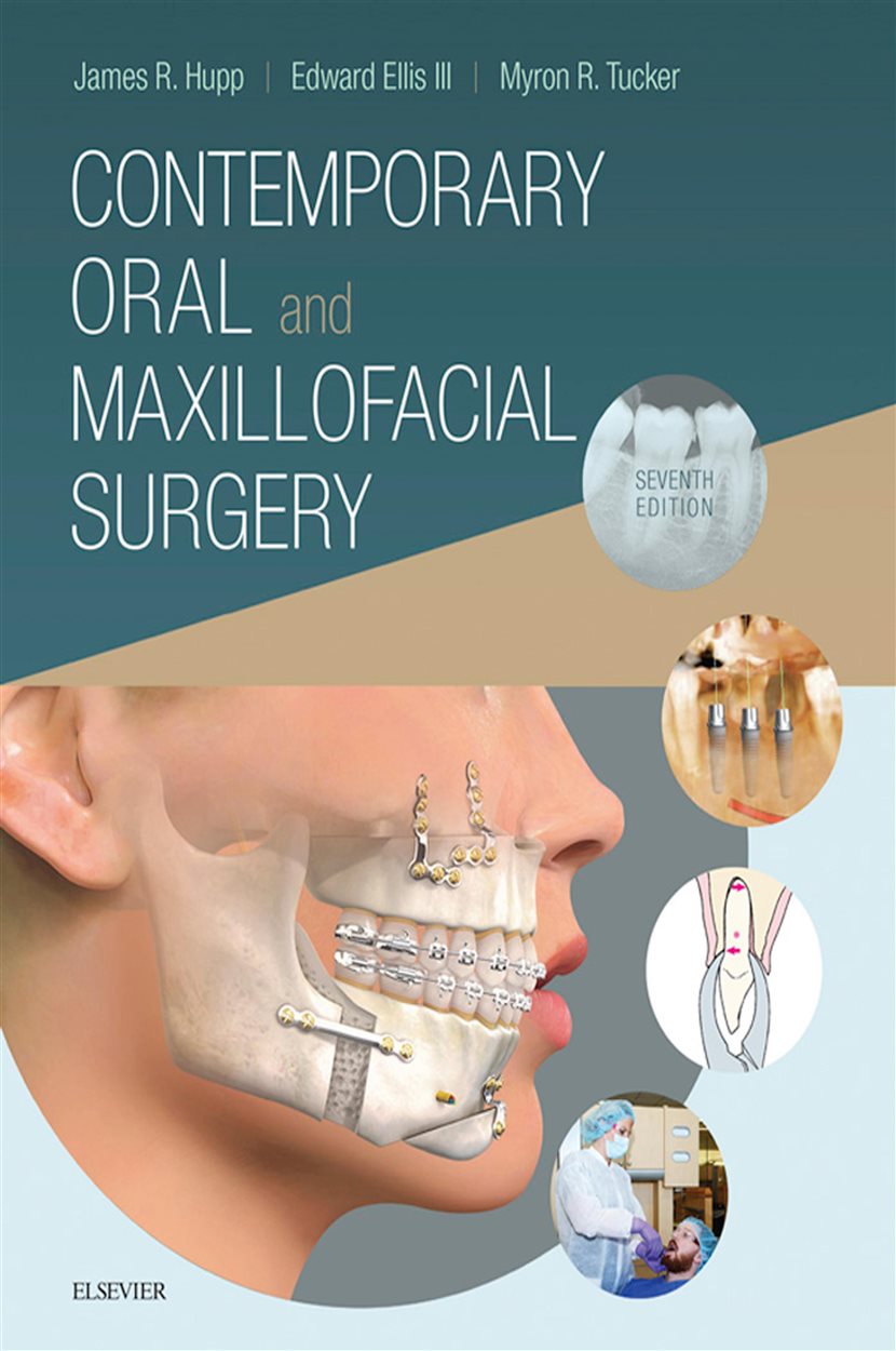 Contemporary Oral and Maxillofacial Surgery E-Book (7th ed.)