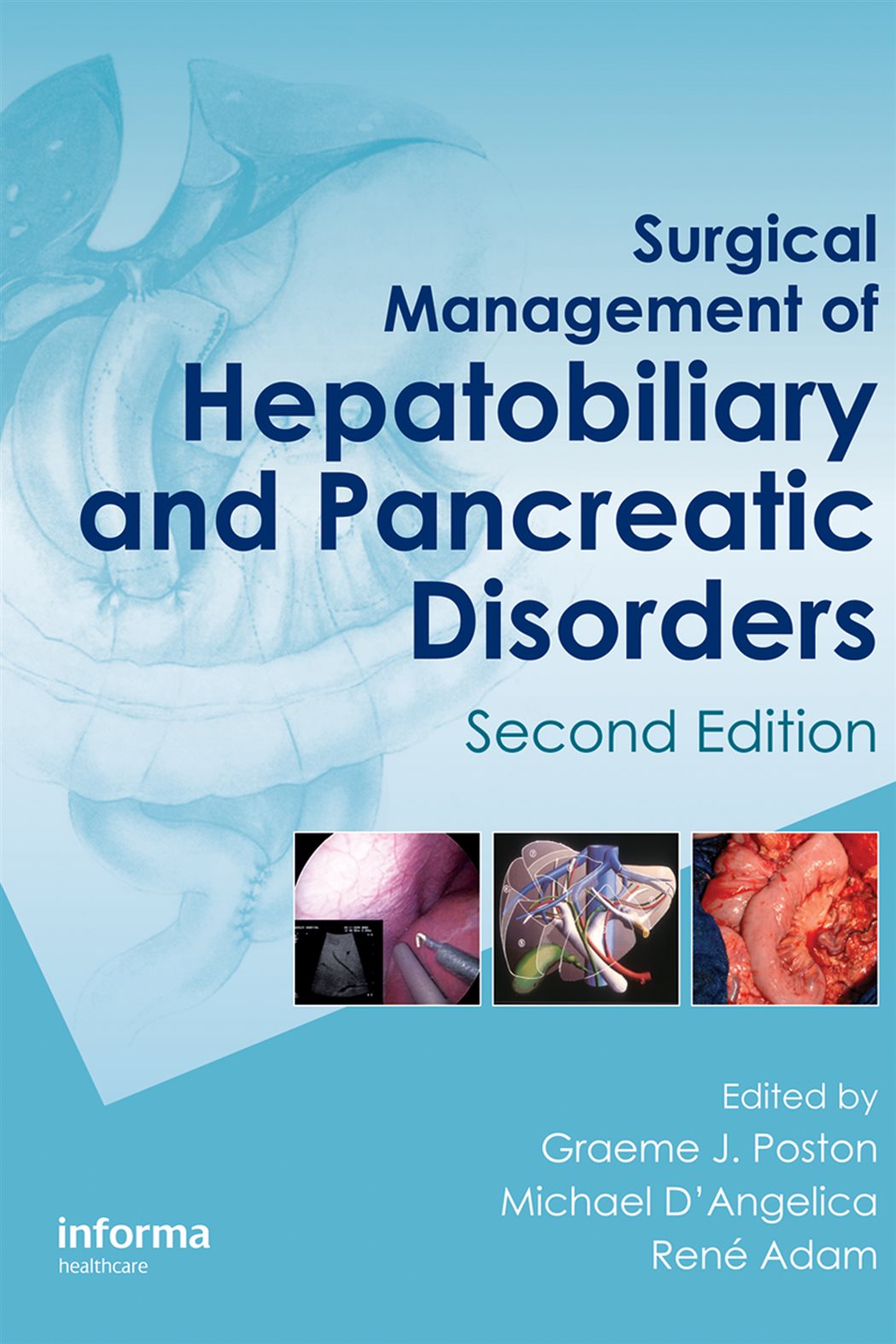 Surgical Management of Hepatobiliary and Pancreatic Disorders, Second ...