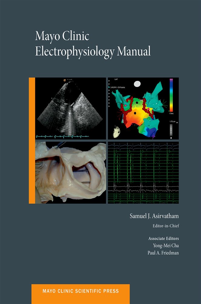 Mayo Clinic Electrophysiology Manual by Samuel J. Asirvatham (ebook)