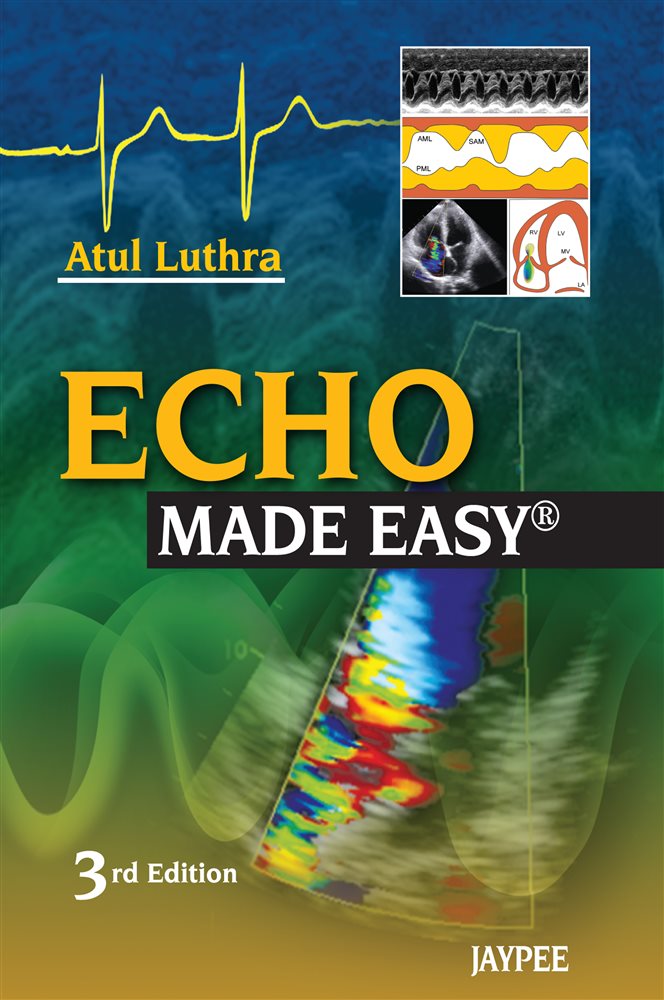 Echo Made Easy® (3rd ed.) by Luthra Atul (ebook)