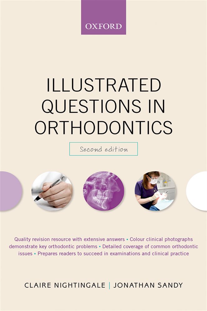 Illustrated Questions in Orthodontics by Claire Nightingale (ebook)