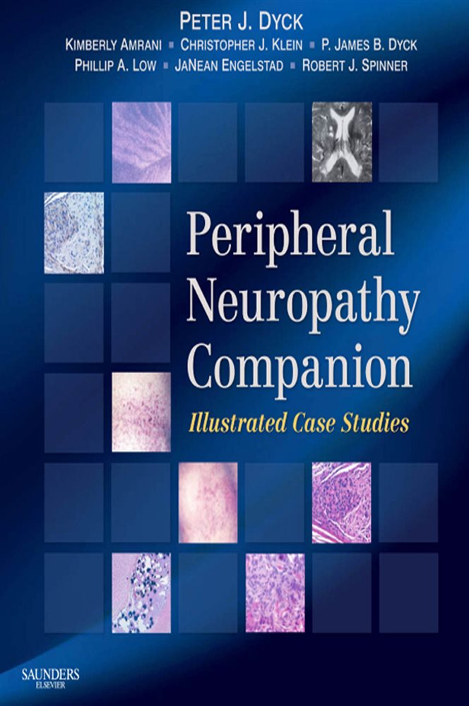 Companion to Peripheral Neuropathy E-Book